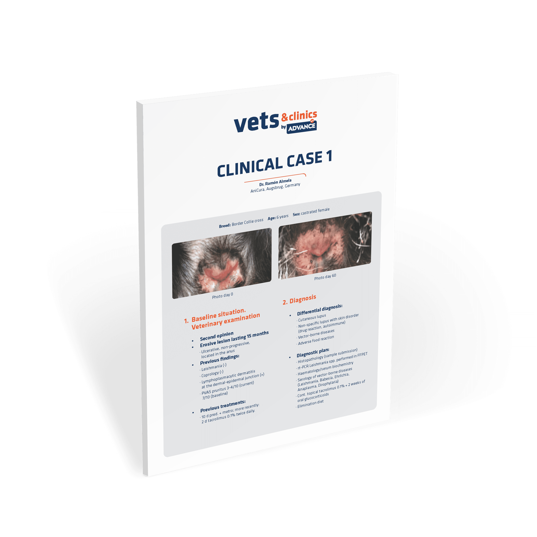 Case Report Mucocutaneous Lupus Erythematosus